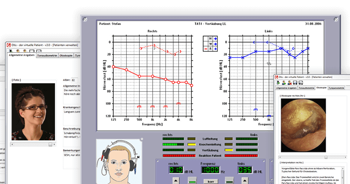 Otis – the virtual patient | INNOFORCE